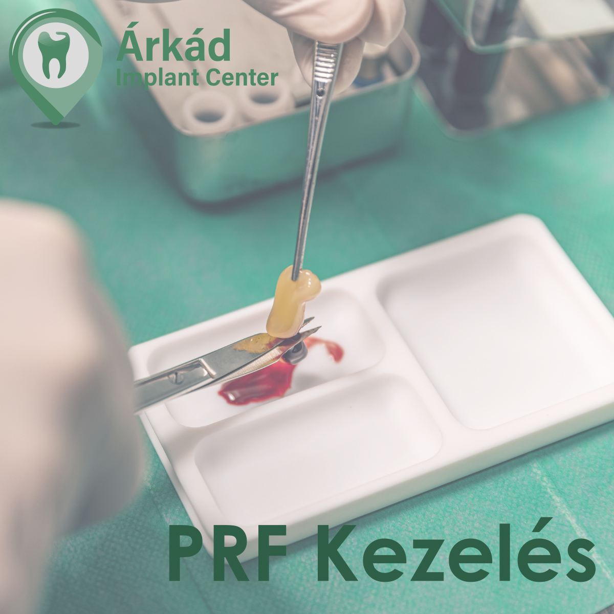 PRF